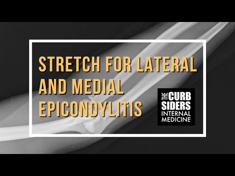 Stretch for Tennis Elbow and Golfer's elbow aka lateral and medial Epicondylitis