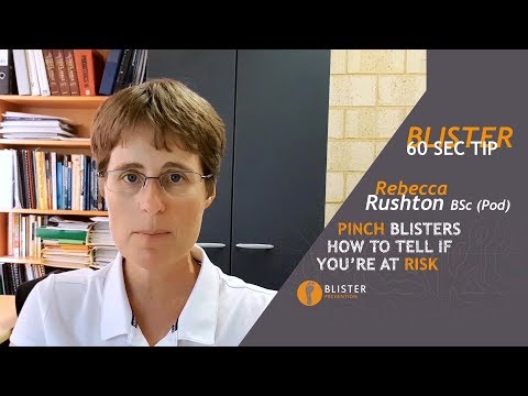#48. Pinch blisters – How to tell if your toes are at risk