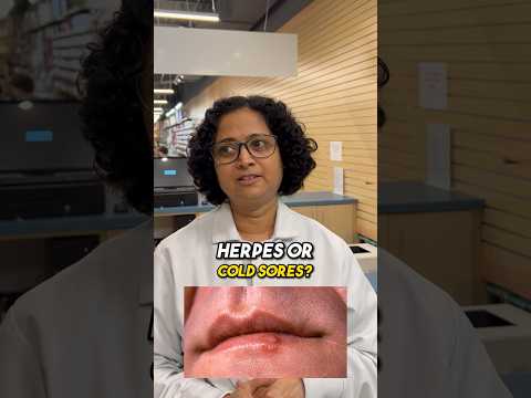 How to cure herpes and cold sores #health #herpesawareness #inflammation