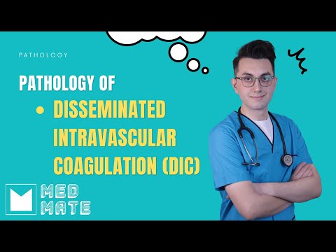 Disseminated intravascular coagulation (DIC)