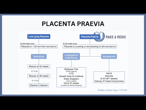 Placenta Praevia Explained