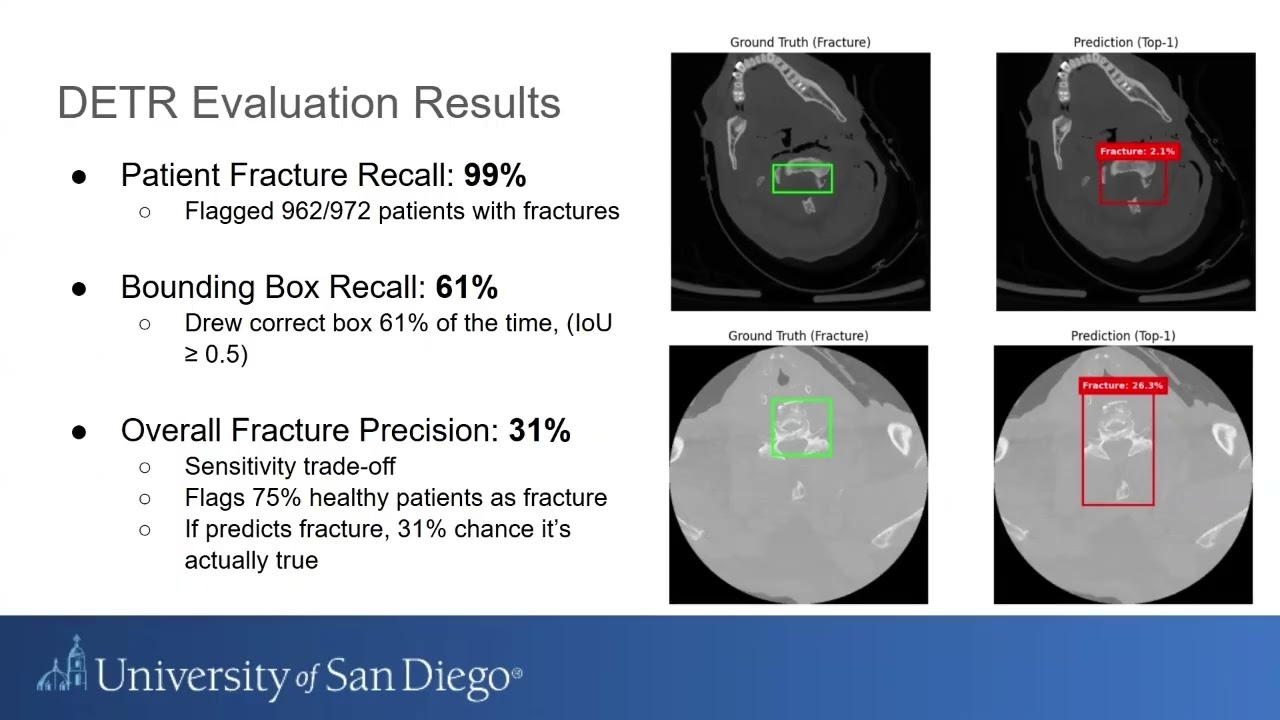 AAI-590 Capstone - Cervical Spine Fracture Detection Using Computer Vision