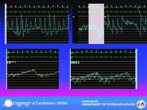 Cardiac Tamponade Case Vignette