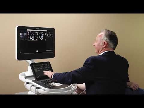 Echocardiogram Machine - Echo Machine Latest Price, Manufacturers ...