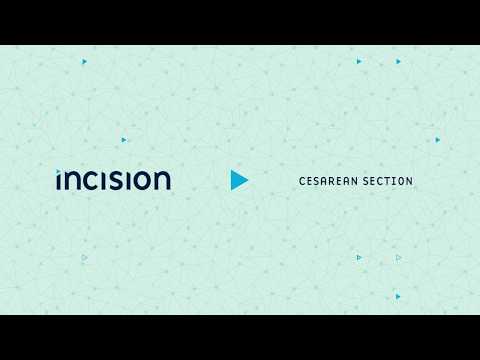 Springer Bohn Stafleu Van Loghum (BSL) Incision collaboration