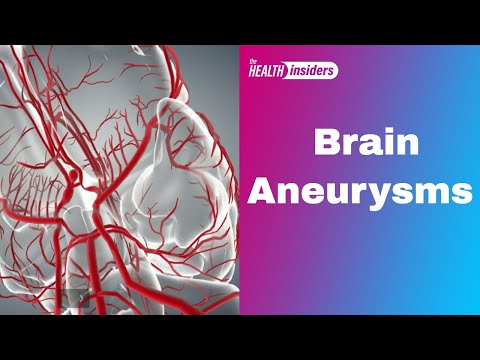 Brain Aneurysms