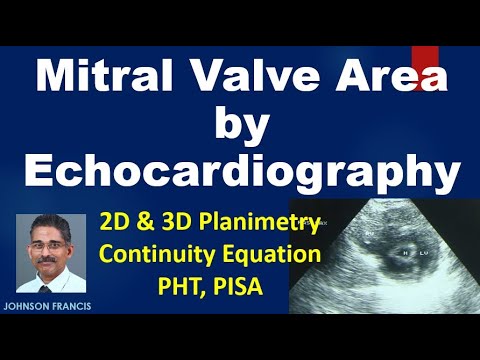 Assessment of Mitral Valve Area by Echo - 3D Planimetry, PHT, PISA