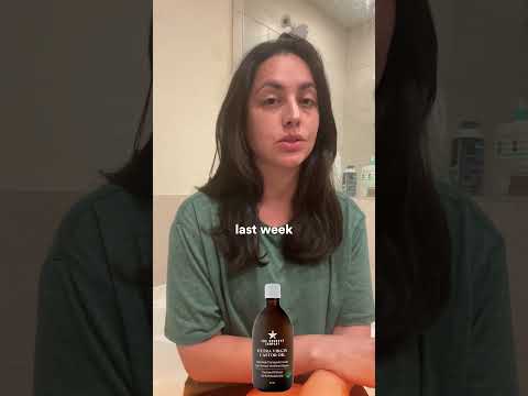 From Bruised to Beautiful: How Castor Oil Works Wonders on Skin