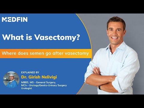 What is Vasectomy