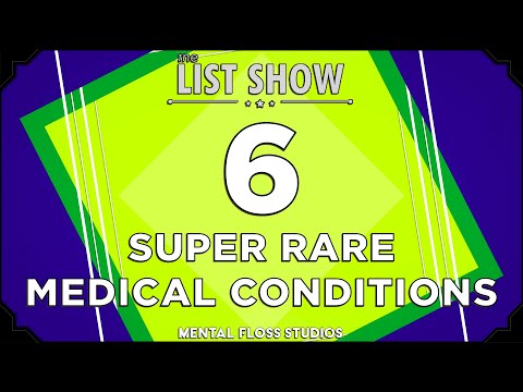 6 Super Rare Medical Conditions