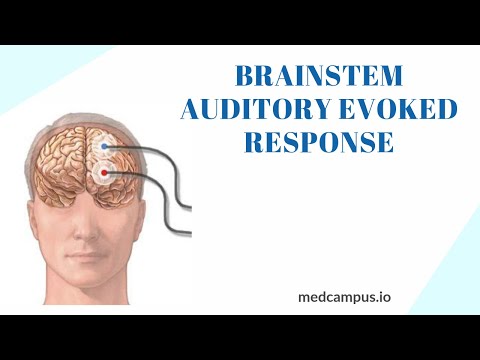BAER (Brainstem Auditory Evoked Response) Test