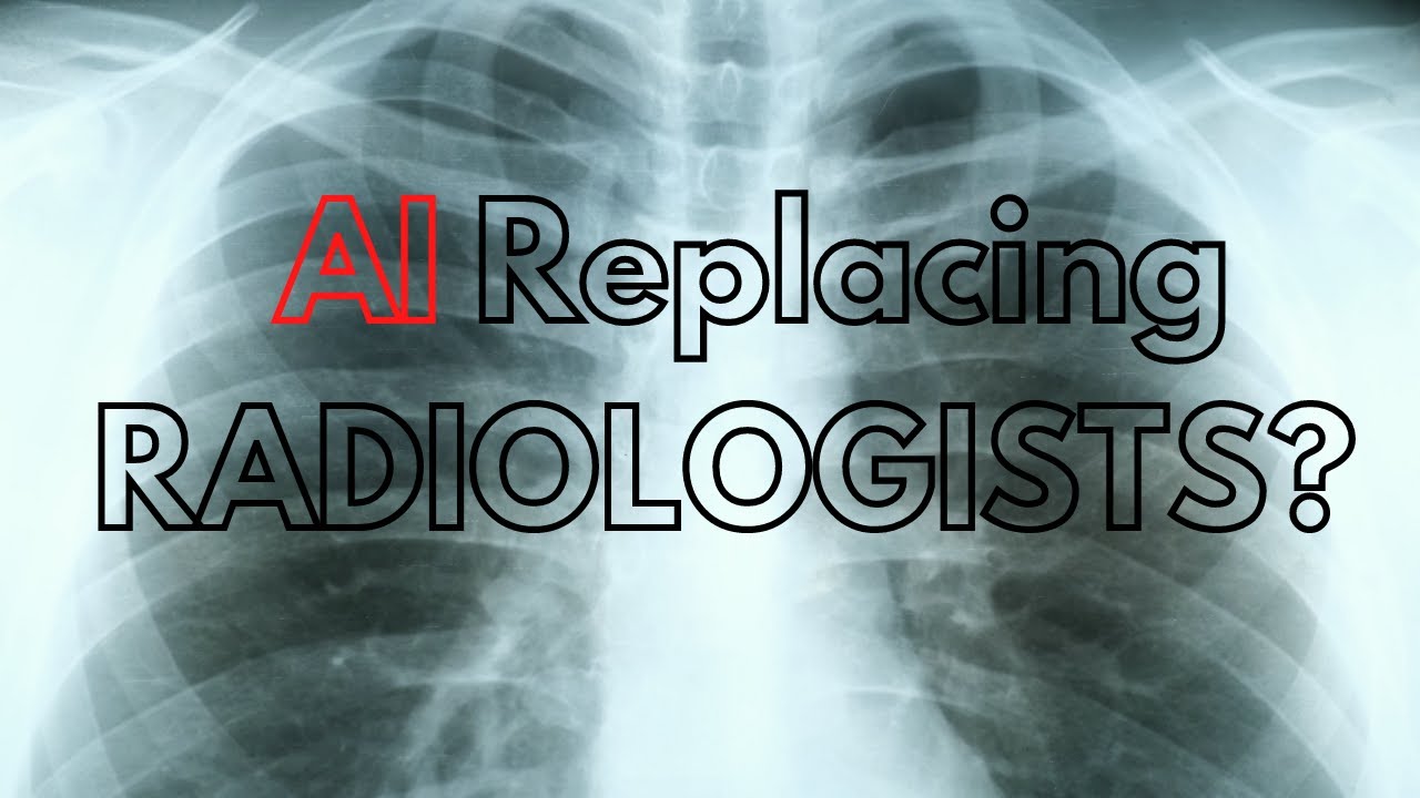 AI replacing doctors? / CheXzero reads chest X-rays