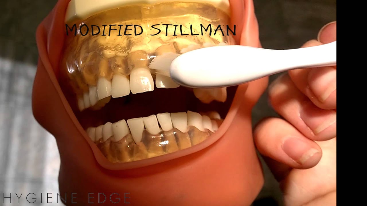 4 Brushing Techniques (Bass, Charters, Modified Stillman, Fones)