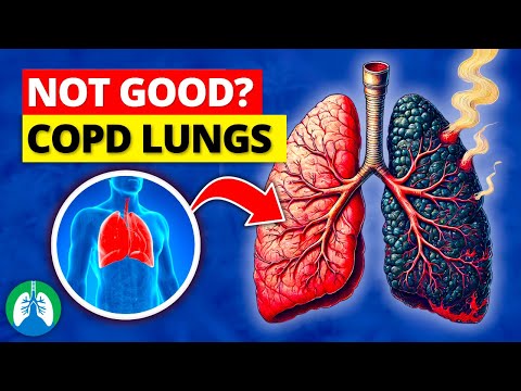 Will My Lungs Heal From COPD If I Quit Smoking?