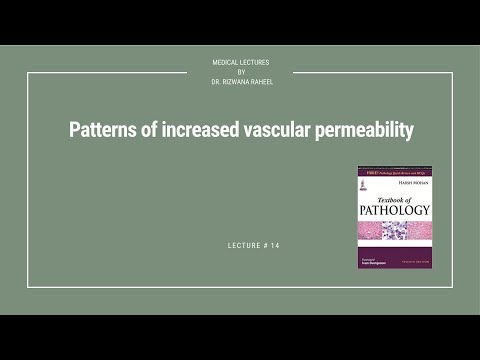 Patterns of increased vascular permeability in Acute Inflammation | Harsh Mohan | Lecture # 14