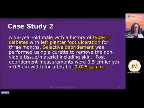 HCGTV: Webinar Snippet - Coding Diabetes with an Ulceration Case Study