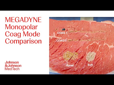 Monopolar Coagulation Modes Comparison with MEGADYNE Electrosurgical Generator | J&J MedTech