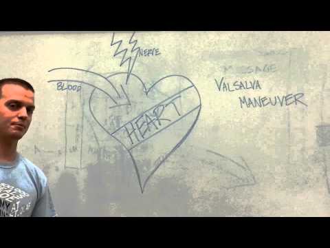 Valsalva Maneuver