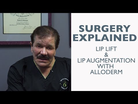 Dr. Schlesinger Explains Lip Lift and Augmentation with Alloderm - Not Graphic