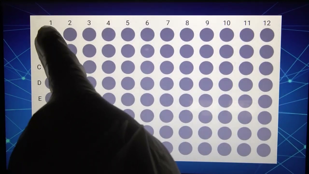 Transfer 96 Automatic sample processing system Video