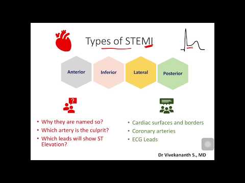 STEMI: Location, Culprit artery and ECG Leads