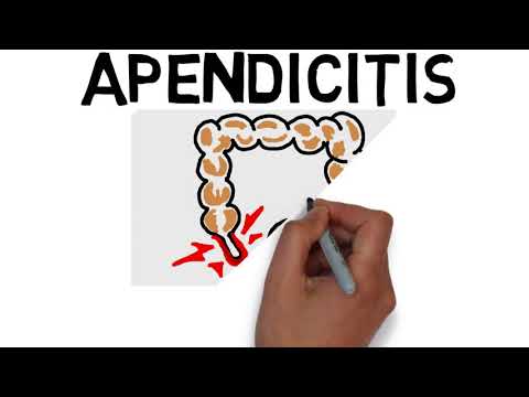 Spanish Medical Interpreter - Spanish Medical Terminology - How to Pronounce Appendicitis in Spanish