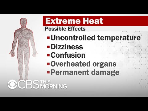 How to spot and prevent heat-related illnesses