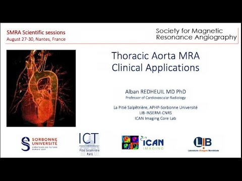 SMRA 14 Alban Redheuil