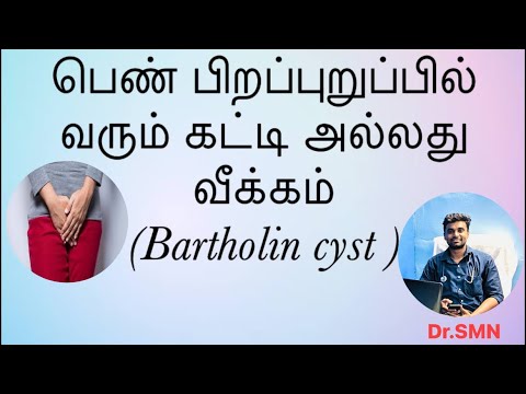 Bartholin cyst in Tamil #vaginalinfection #cyst #swelling #abscess #pain #doctor#Homoeopathy#madurai