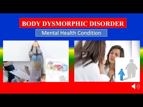BODY DYSMORPHIC DISORDER - Definition, types, causes, pathophysiology, sympt, diagnoses , medicine