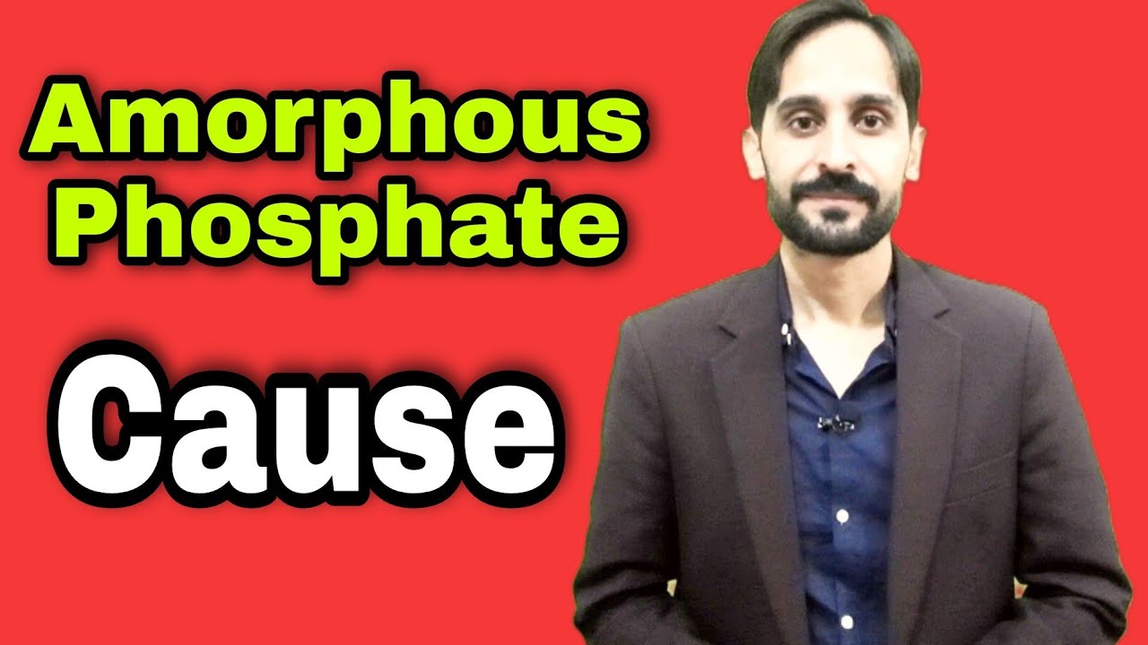 The Only Amorphous Phosphate in Urine Video You Need to Watch