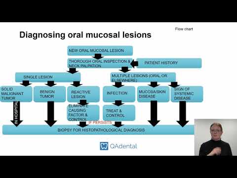 Video lecture: Diagnosing Oral Mucosal Lesions