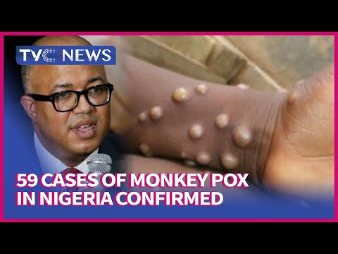 [TVC BREAKFAST] NCDC Confirms 59 Cases Of Monkey Pox In Nigeria
