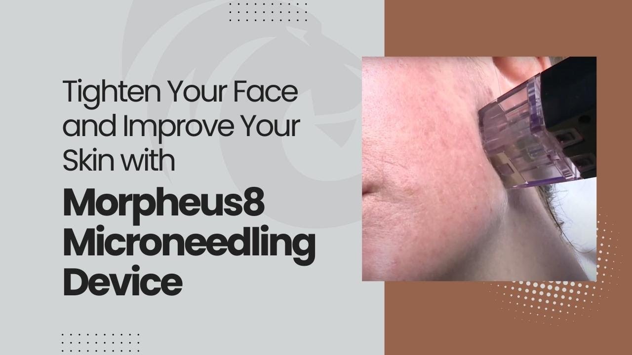 Tighten Your Face and Improve Your Skin with Morpheus8 Microneedling Device | Dr. Jason Emer