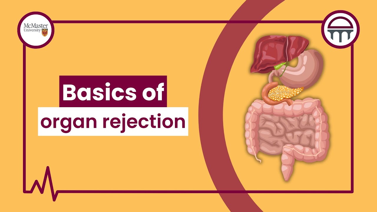 Basics of organ rejection