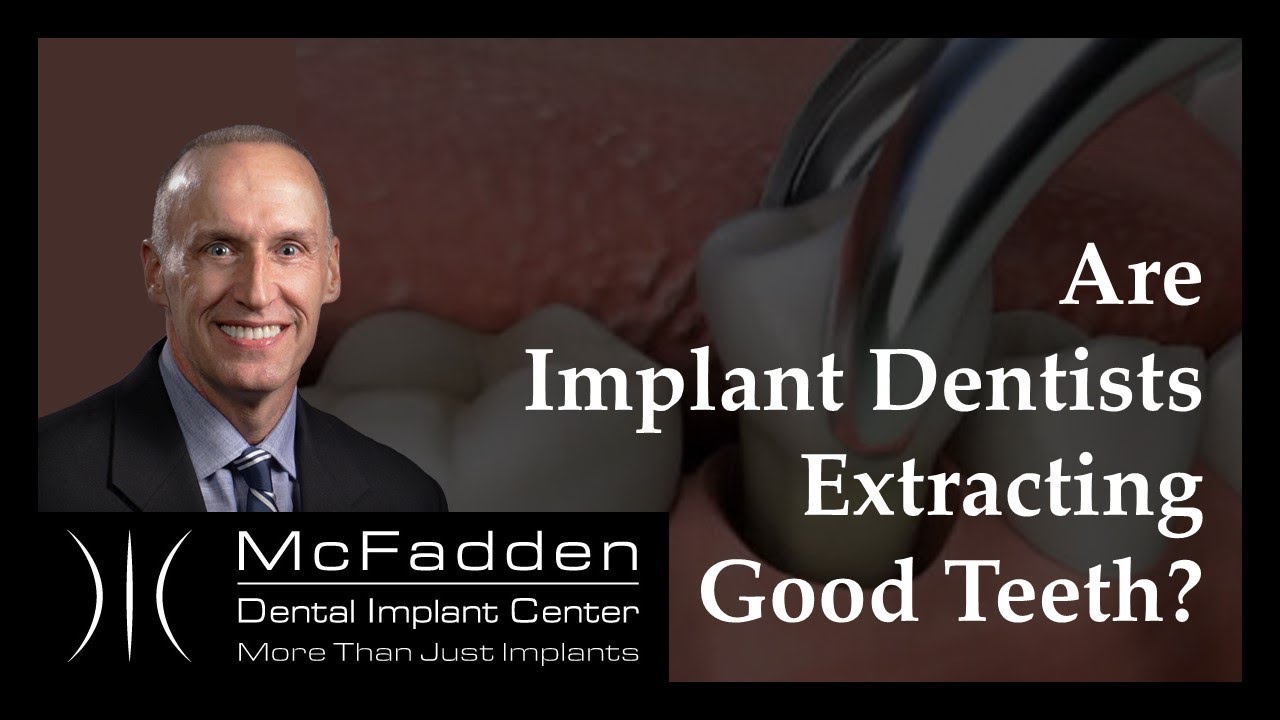 ARE Implant Dentists Extracting Good Teeth?