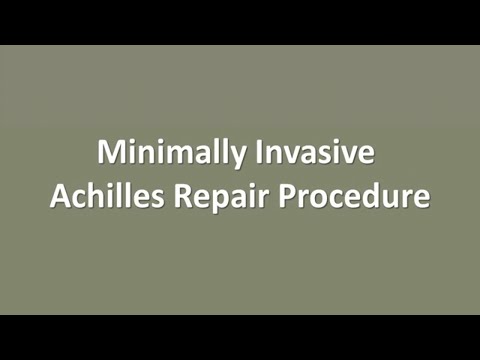 Minimally Invasive Achilles Tendon Repair Surgery with UCLA Affiliated Foot & Ankle Surgeon