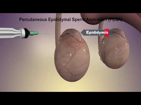Best Andrology Gynaecology Infertility Centres || PESA, MESA, TESA, TESE, MAESA