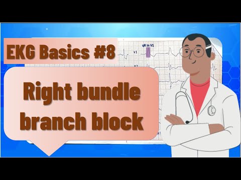 ECG basics | right bundle branch block (RBBB) | ECG findings and examples, clinical significance
