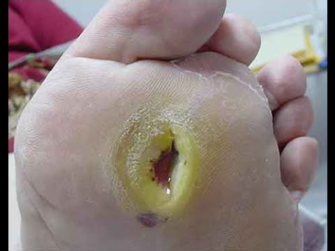 Psuedomonas High yield Topic Microbiology for USMLE Step 1 prep www.anatomy2medicine.com