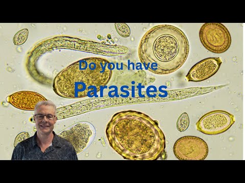 Do you have Parasites?