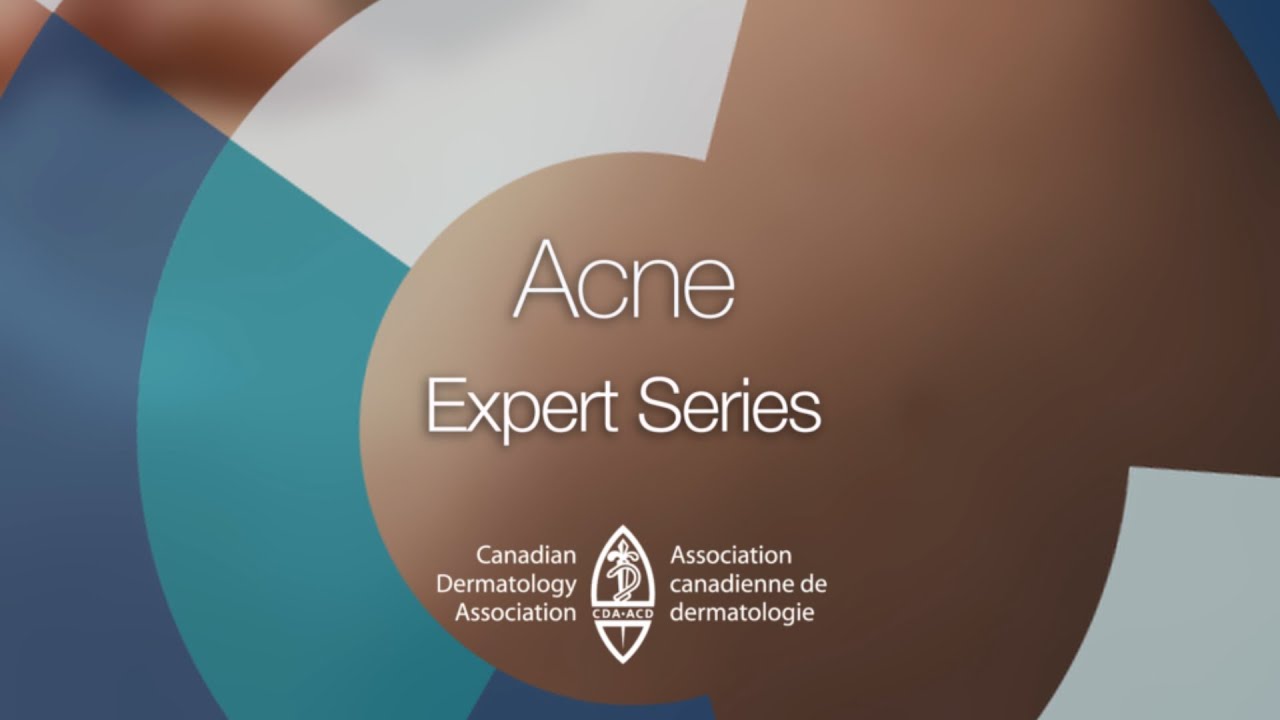 CDA Expert Series - Dr. Diana Diao on Acne