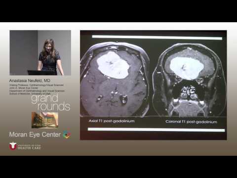 Frontal Lobe and The Eye