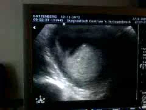 Expected date of arrival 5 oct 2009