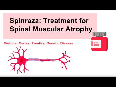 Spinraza: Treatment for Spinal Muscular Atrophy – The MedGen Project