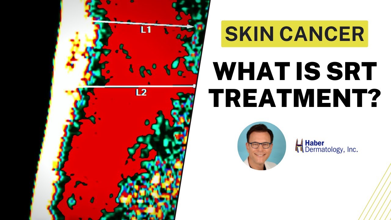 Image-Guided Superficial Radiotherapy (SRT) | Mohs Surgery Alternative | Robert Haber, MD