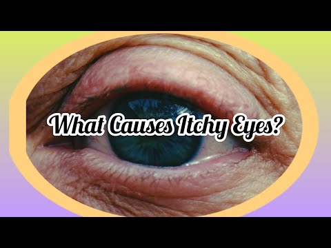 What Causes Itchy Eyes?