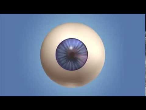 Glaucoma How the Eye Sees