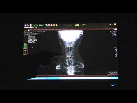 manual labor jobs and what they do to the spine