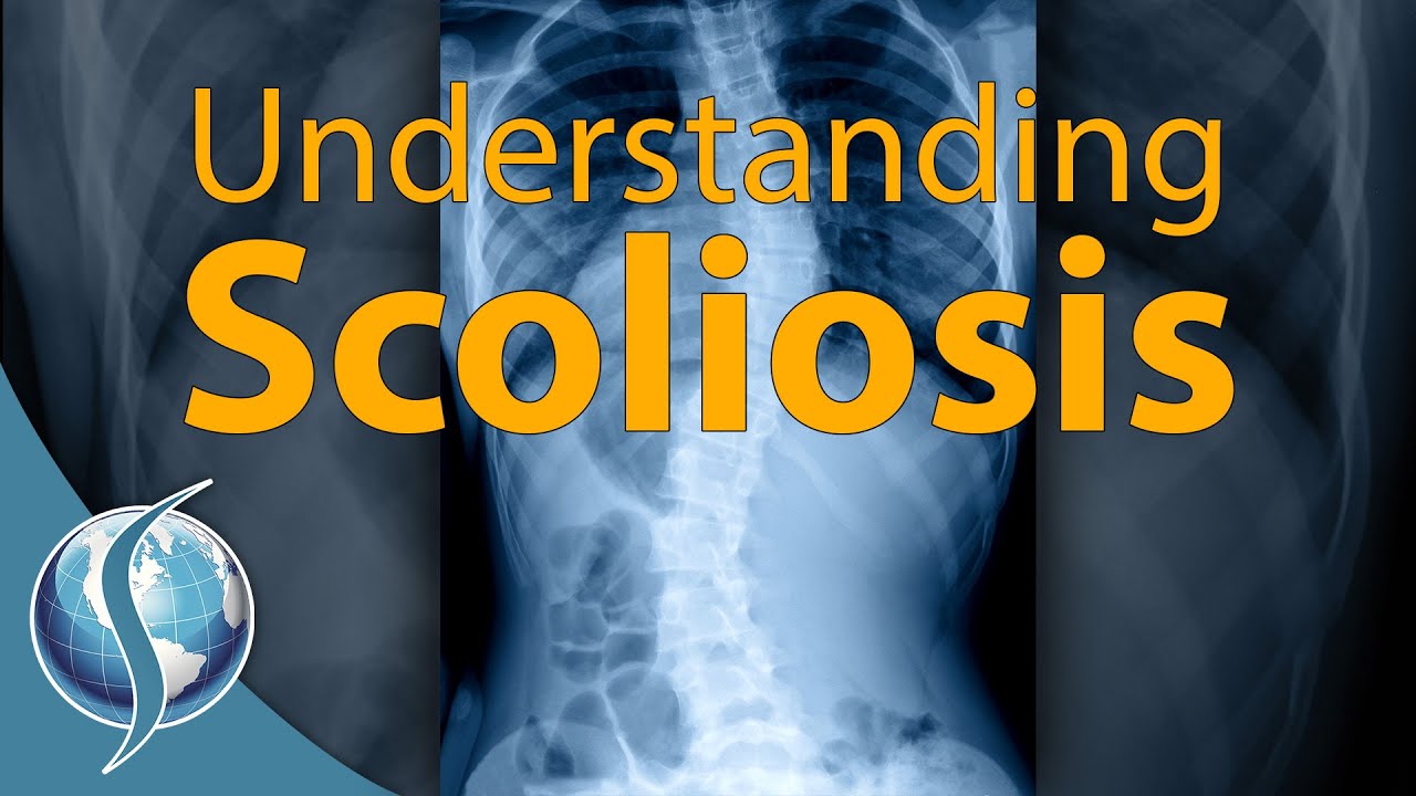 Understanding Scoliosis